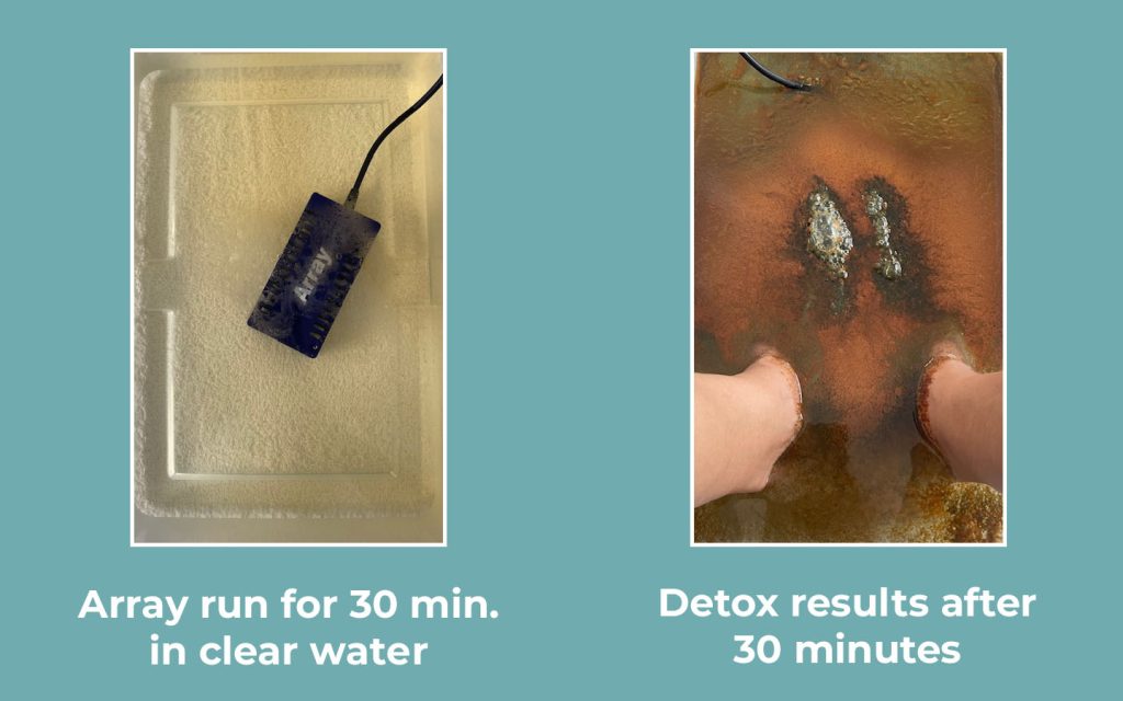 Ionic Foot Detox – Regeneration Room